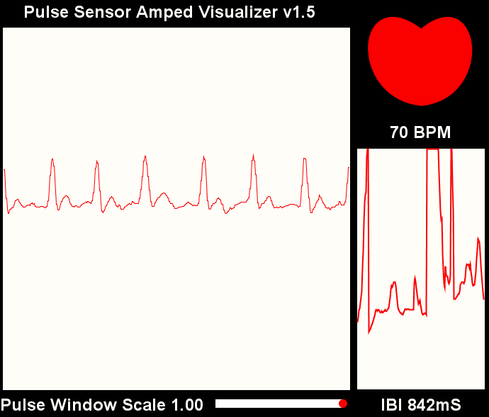 A cloth can hear your heartbeat